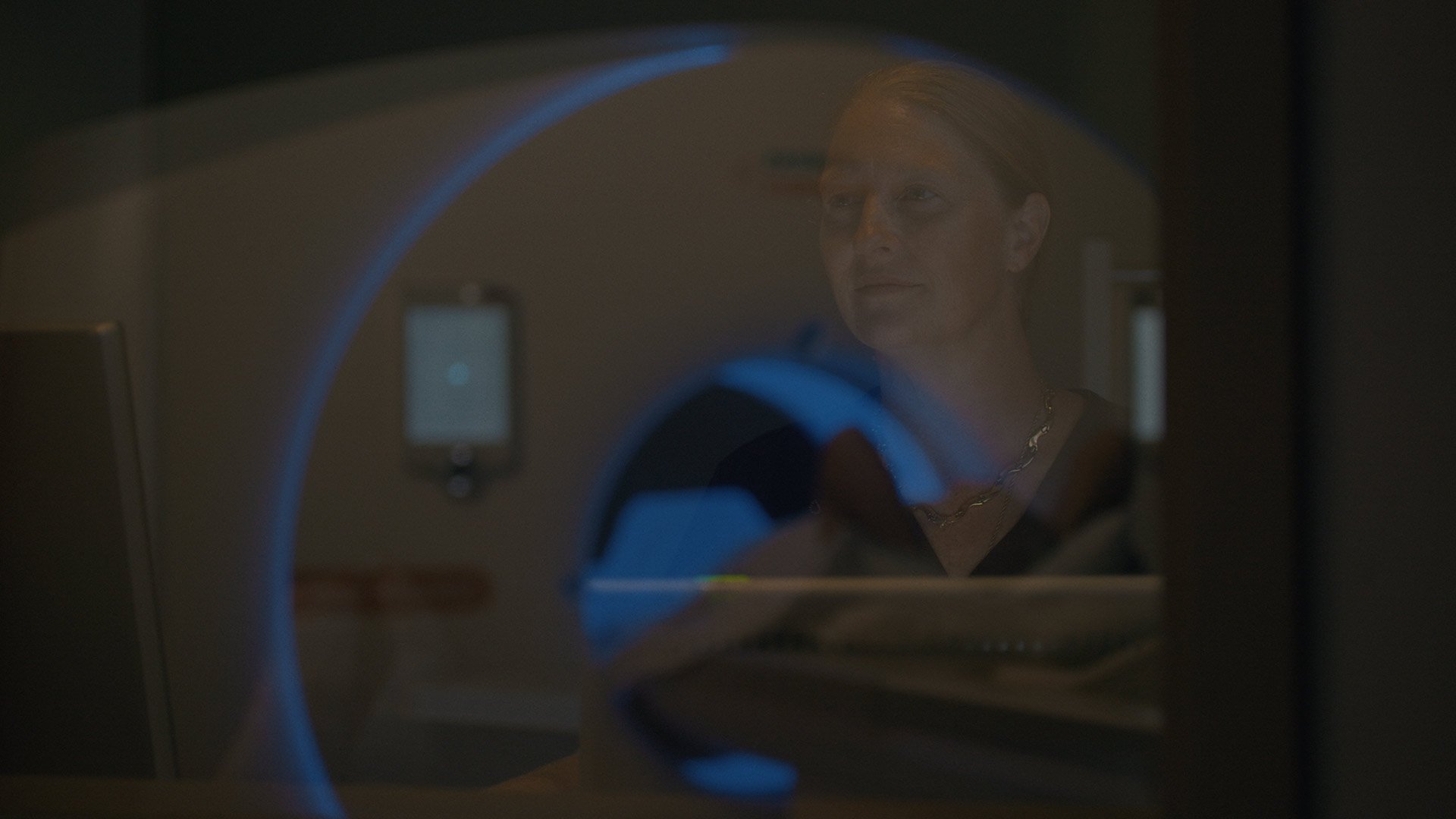 Plaque Detection and Early Intervention with Cleerly's AI Innovations