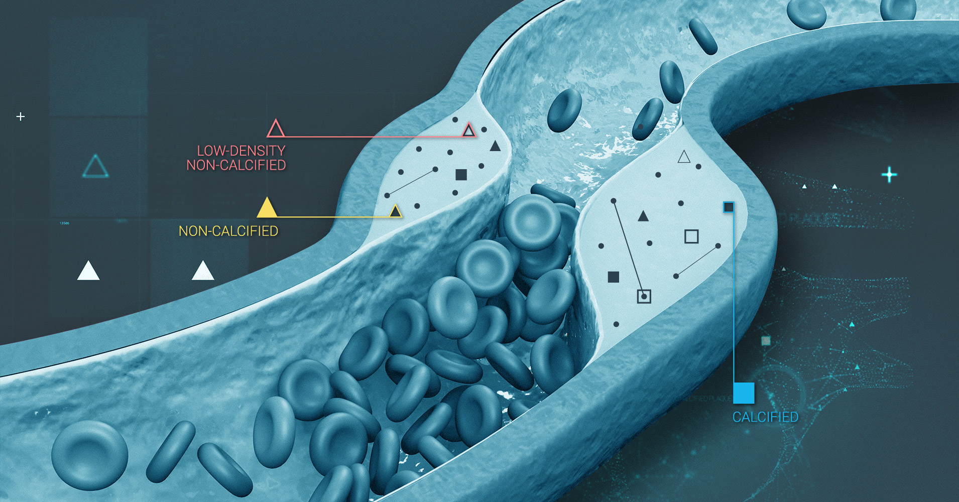 Heart Health Blog | Cleerly, Inc