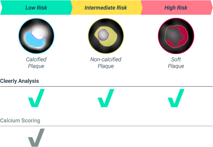 Patient Education: Cleerly Plaque Analysis for Heart Disease Detection
