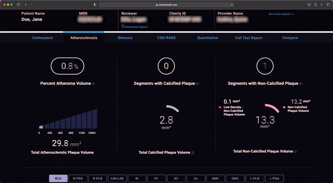 What is Cleerly | Cleerly Coronary CT Scan Analysis